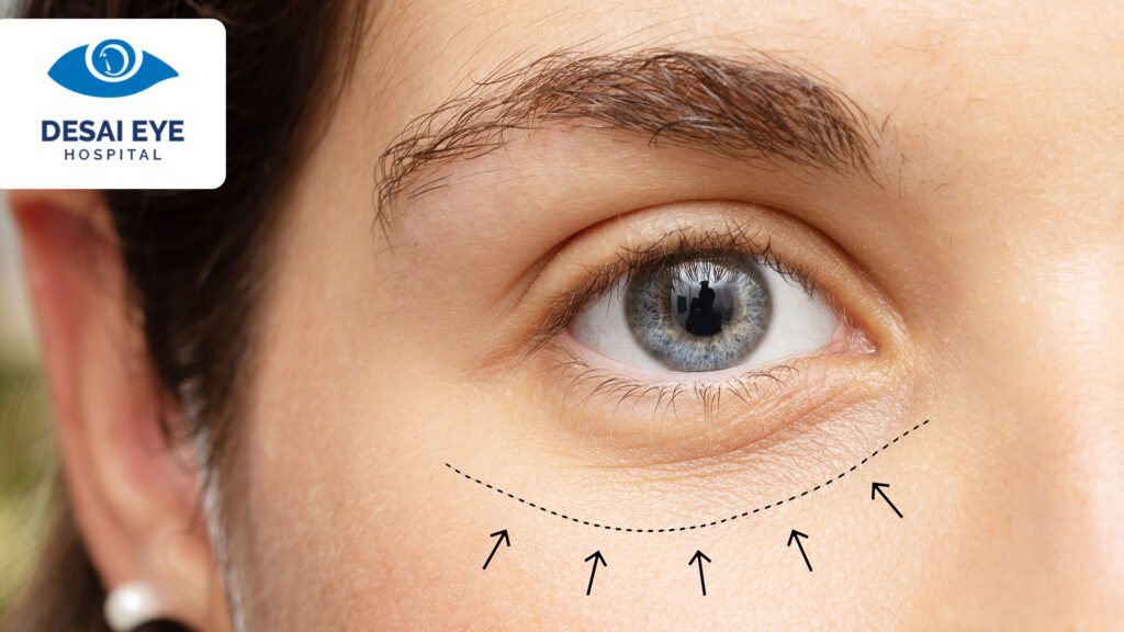 What Are Oculoplastics and Orbit Diseases? Signs, Symptoms, and ...