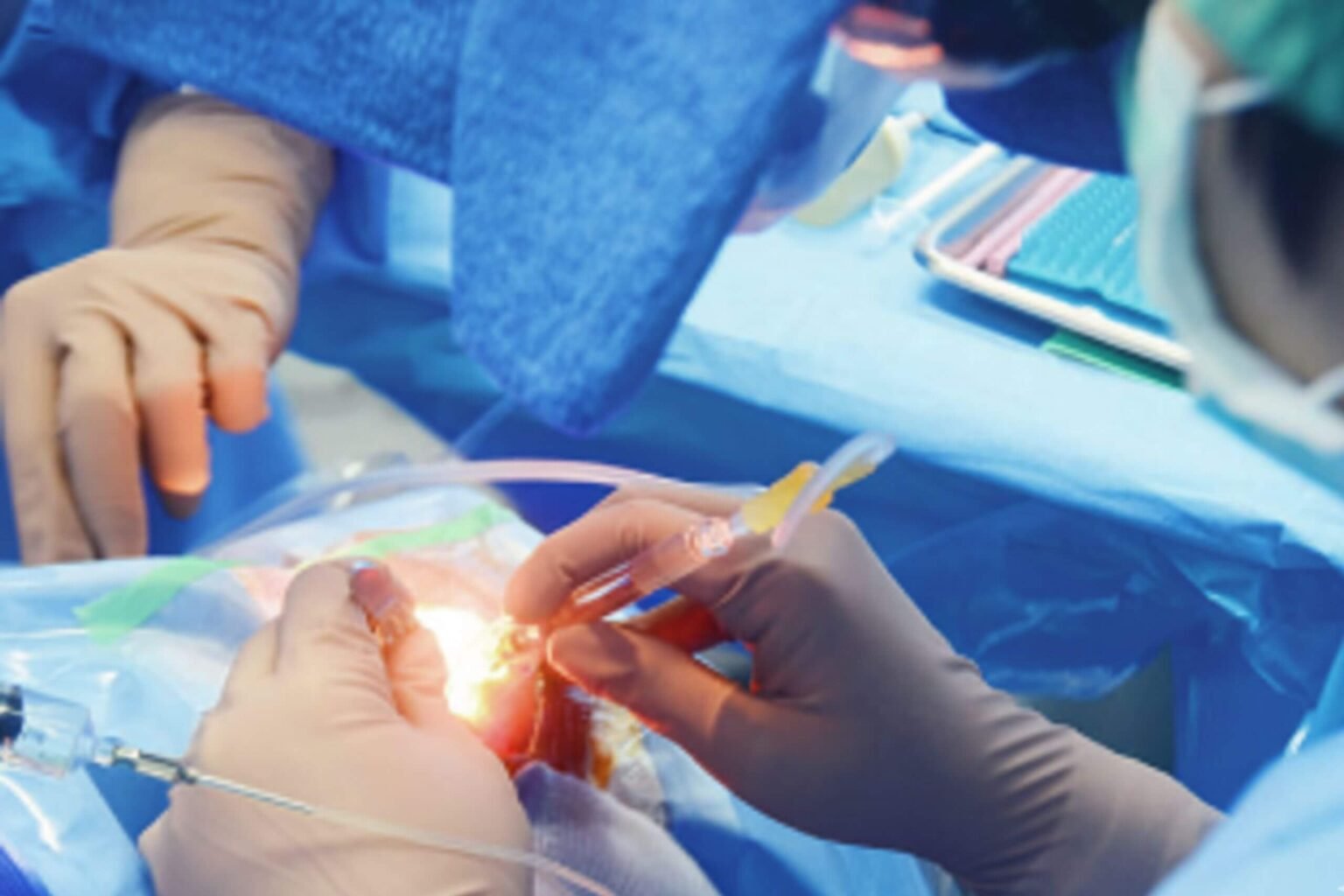 Preparing for Laser Eye Surgery Pre Testing and Eye Care